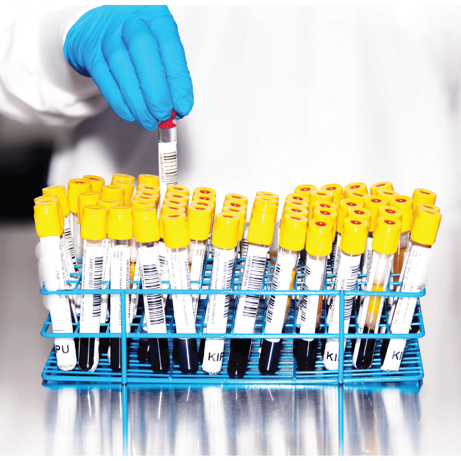 Toxicology Testing - Gravity Diagnostics
